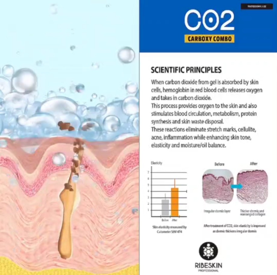 CO2 Lifting Gel (Carboxy Mask) – Villa Clinic